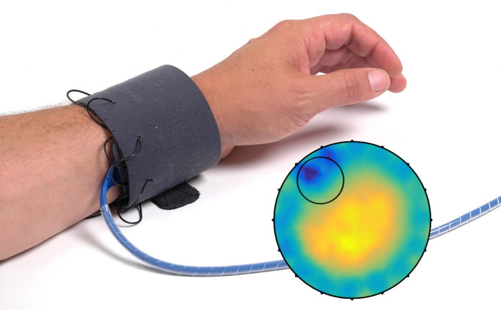 Electrical Impedance Tomography (EIT) | Scalable Imaging – Sciospec
