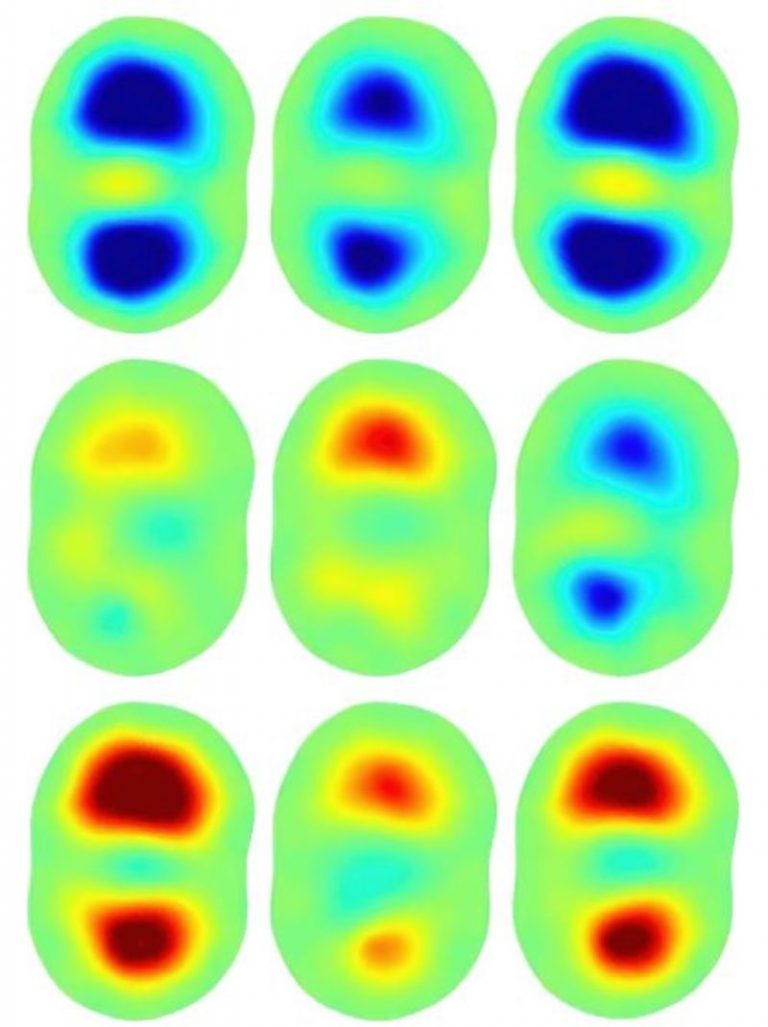 Sciospec's EIT Electrical Impedance Tomography - Sciospec